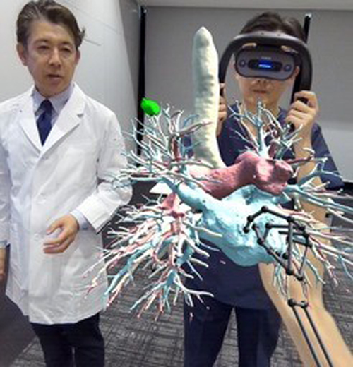 Canon and others observe lung structure with MR｜電経新聞